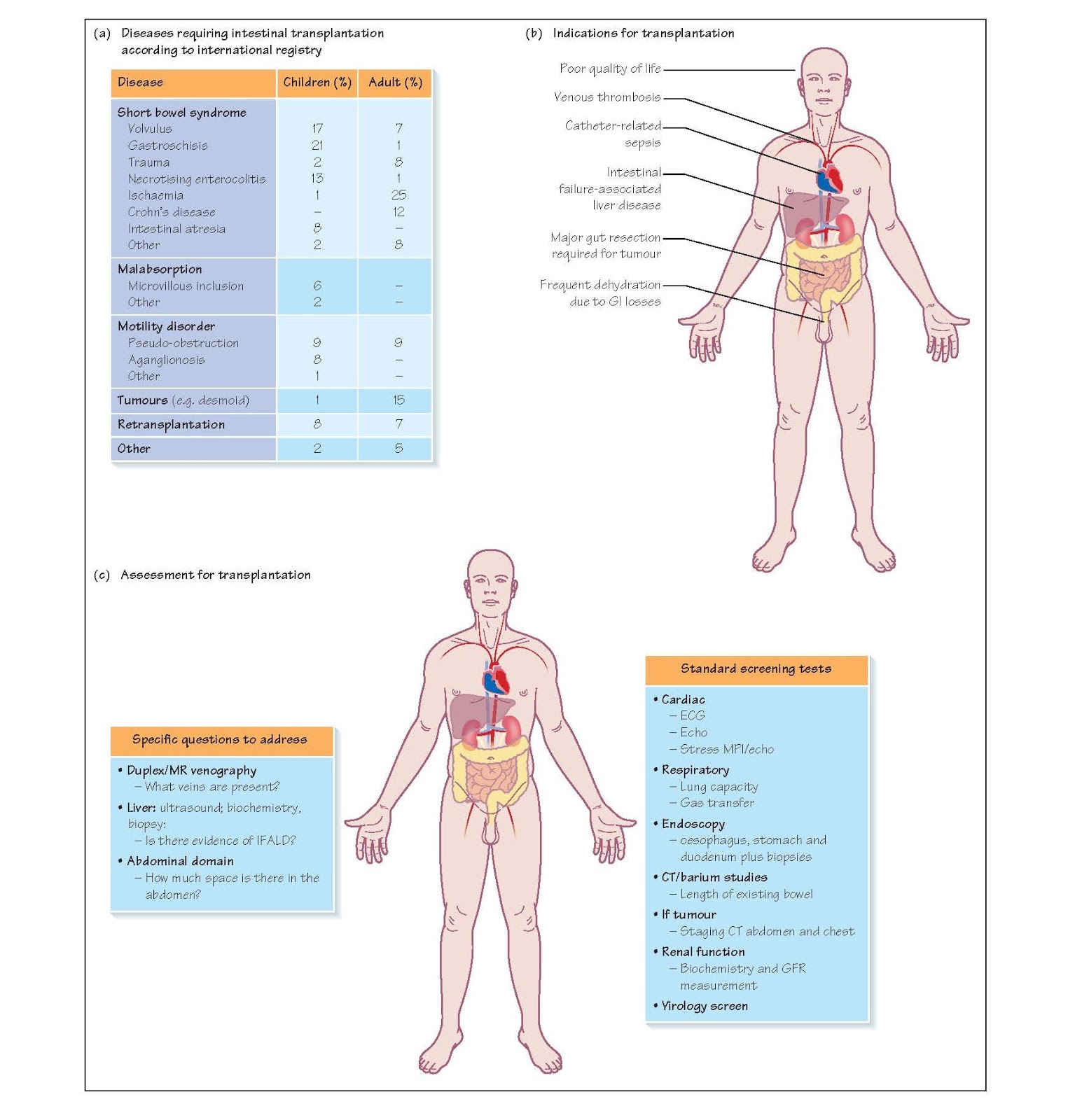 Intestinal Failure And Assessment - pediagenosis