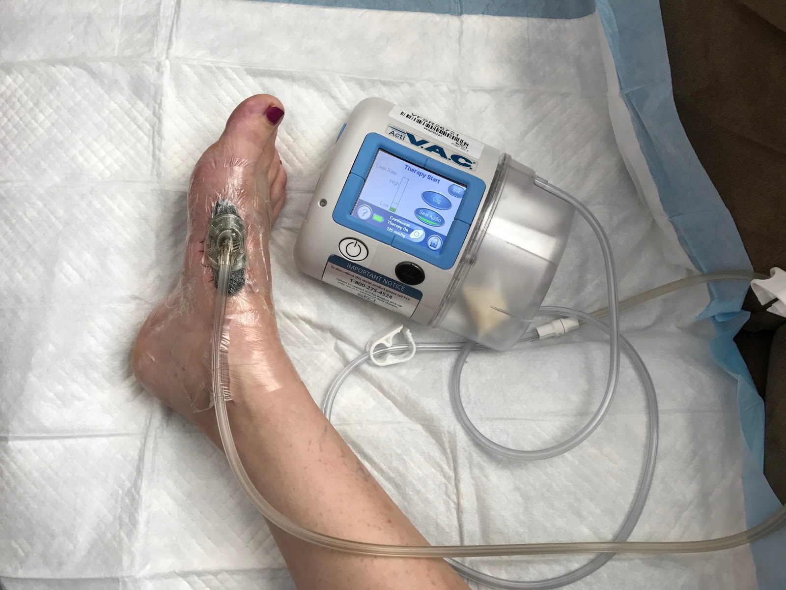 Ella's Corner: Discouraged (by Lindsay)