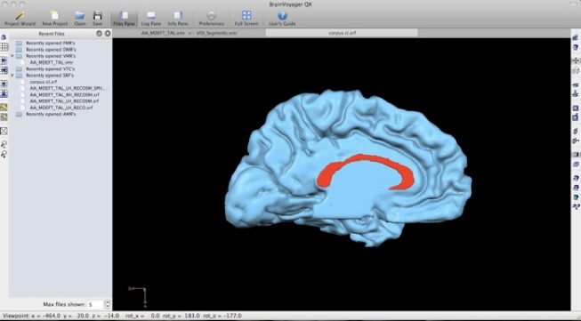 Neuroimaging Made Easy : Brainvoyager QX tips and tricks 2; Create a 3d ...