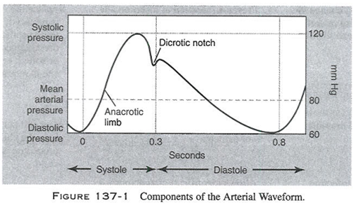 Invasive Arterial Pressure Monitoring ppt Free Medical Slids Invasive Arterial Pressure Monitoring ppt Free Medical Slids