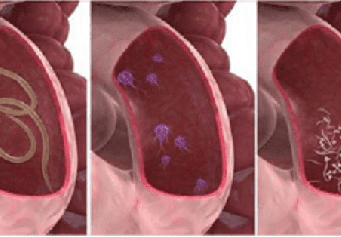 OVI ZNAKOVI UKAZUJU NA PARAZITE U STOLICI: Ovako prepoznajte jesu li ...