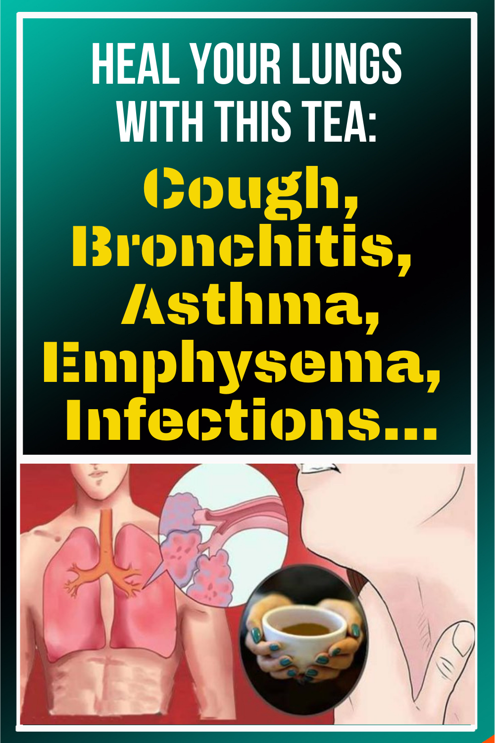 Heal Your Lungs With THIS Tea: Cough, Bronchitis, Asthma, Emphysema ...