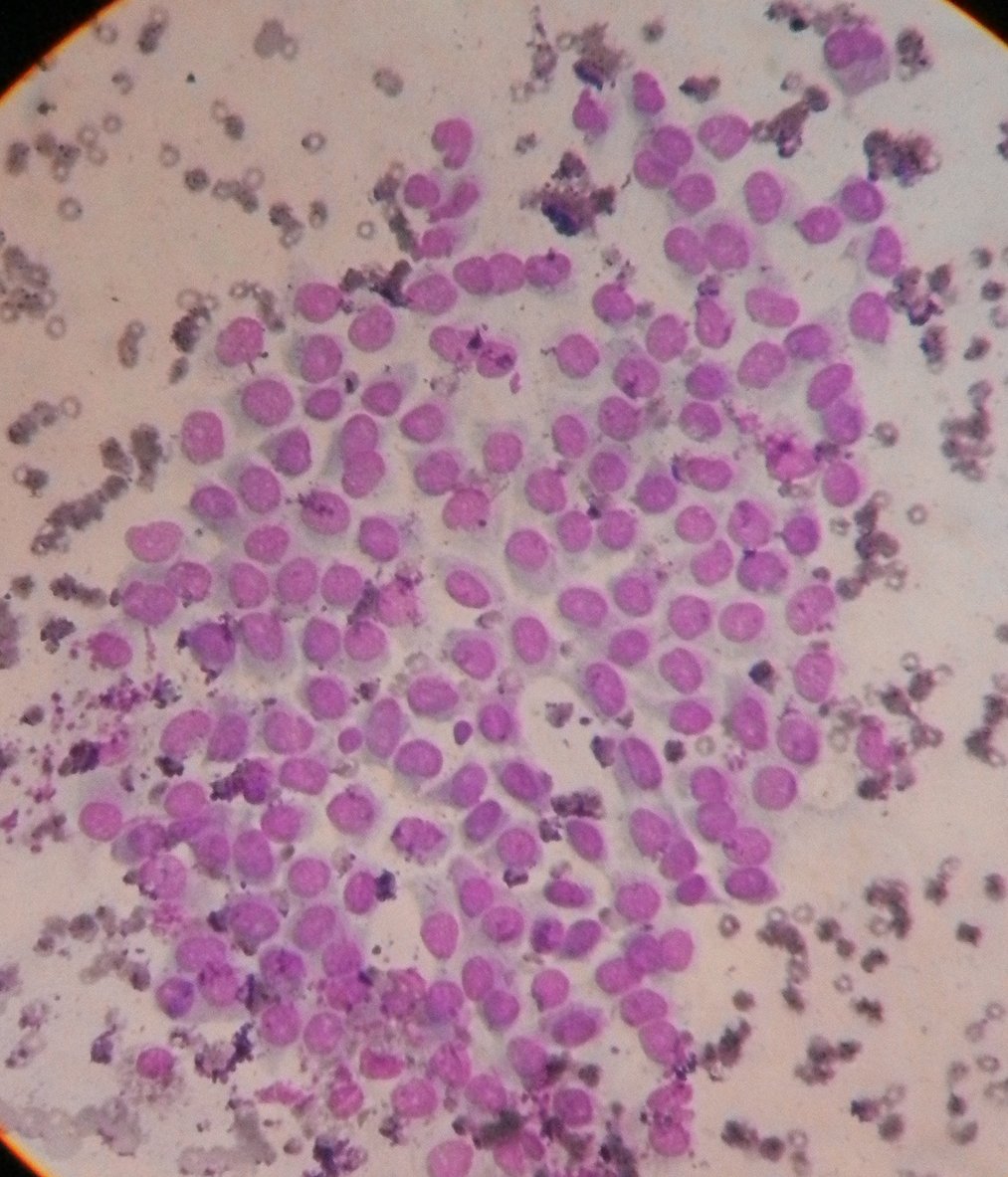 into the roots: Lung cytology