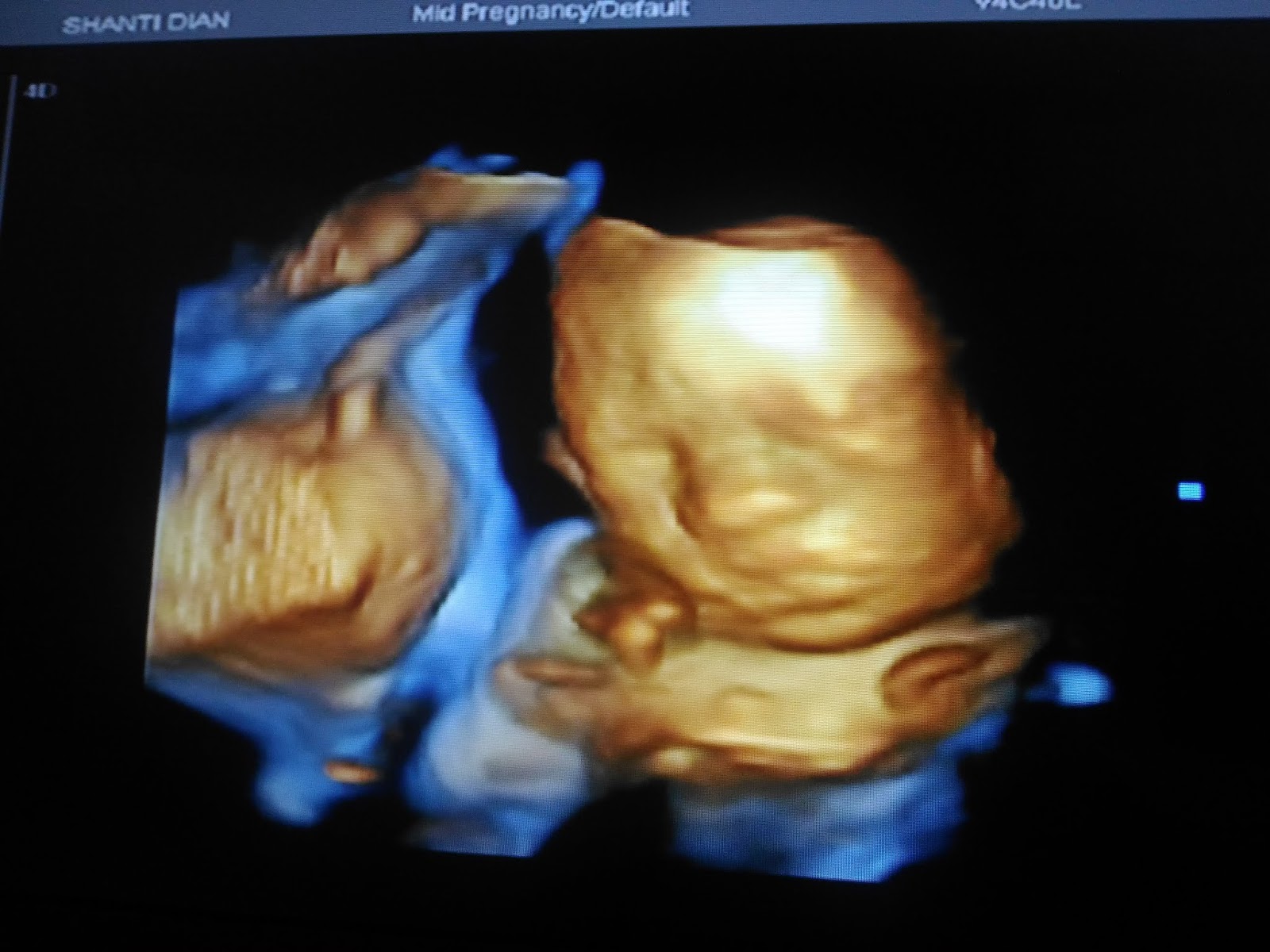 USG 4D MURAH DI SEMARANG (KLINIK PRATAMA SEHAT UTAMA) TAHUN 2019