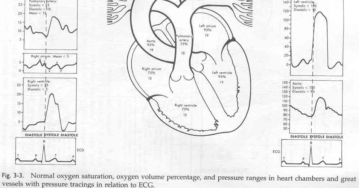 Pedi cardiology: Cath Lab _ Normal values