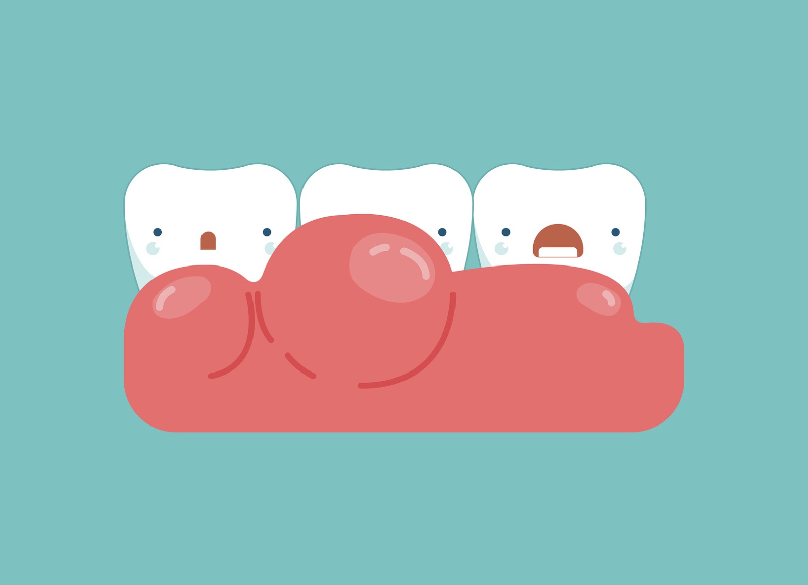 Regency Dental Group: Stages of Gum Disease