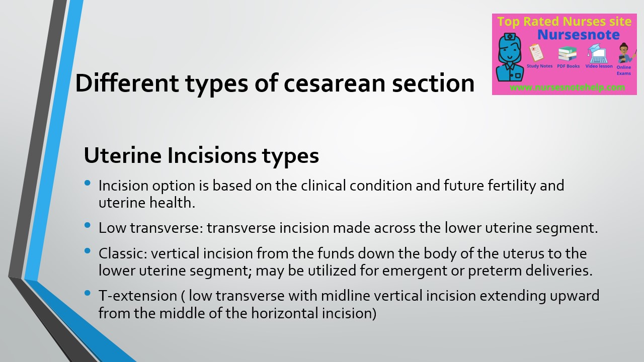 Cesarean Delivery or Cesarean Section: Types, Indications, Management ...
