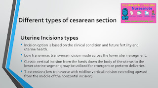 Cesarean Delivery or Cesarean Section: Types, Indications, Management ...