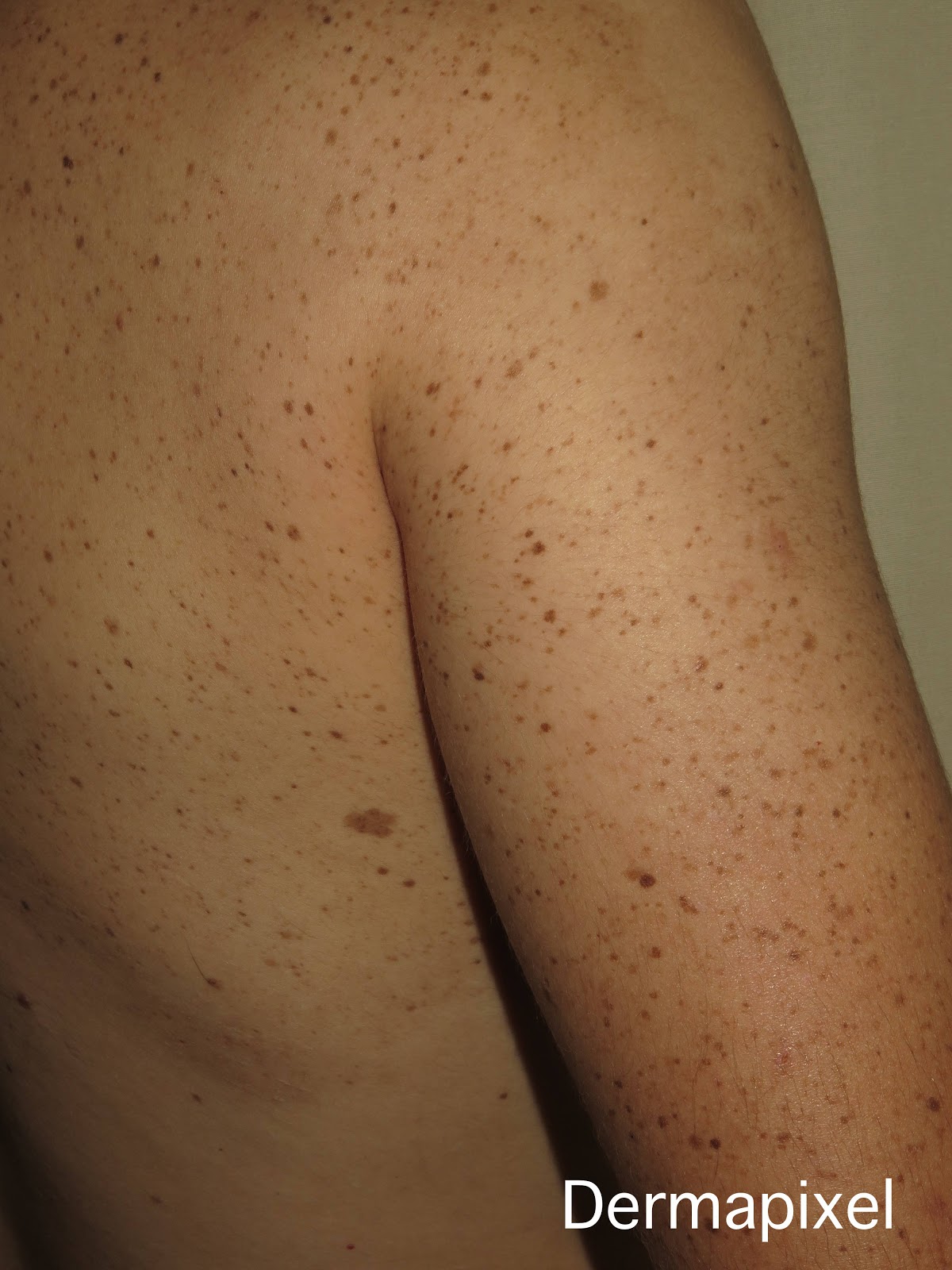 Dermapixel: junio 2019