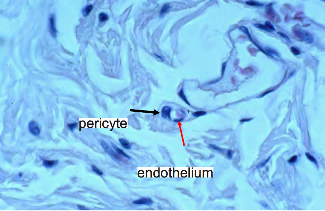 Histology Doodles: Pericyte; Stain(?)