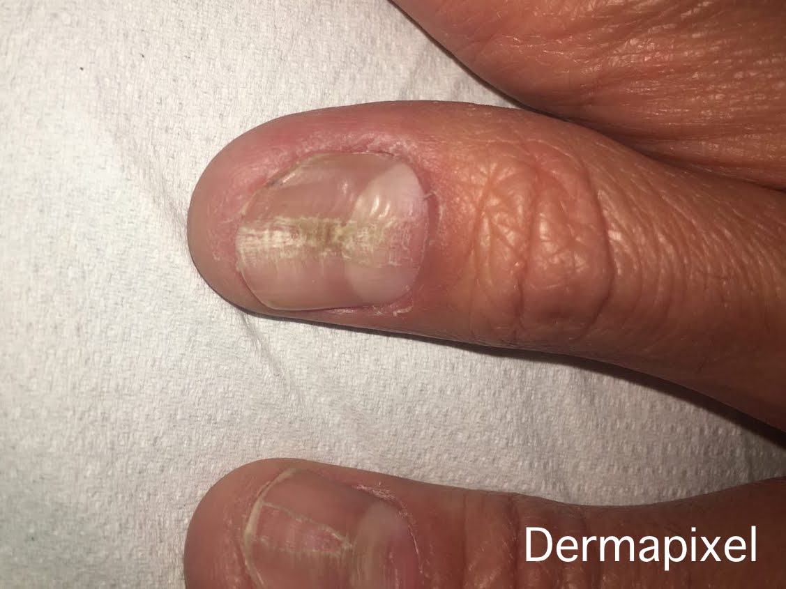 Dermapixel: mayo 2019