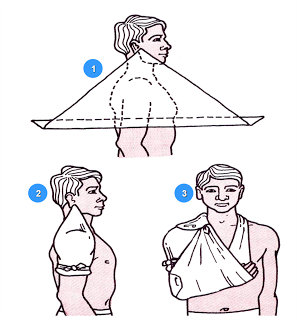 PPM 01 Seremban Timur Negeri Sembilan: BALUTAN ANDUH