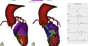 RADIOLOGIA: Resonancia magnética del corazón