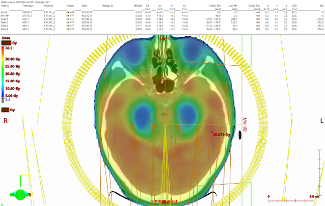 D A R K S A Y I N G S: The End of the 6th Week (August 2020 Scan Results)
