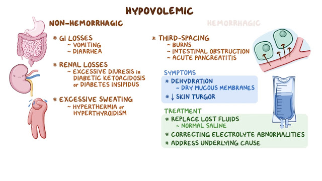SOK; TUM SOK TIPLERI