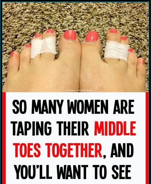 So Many Women Are Taping Their Middle Toes Together, And You’ll Want To ...