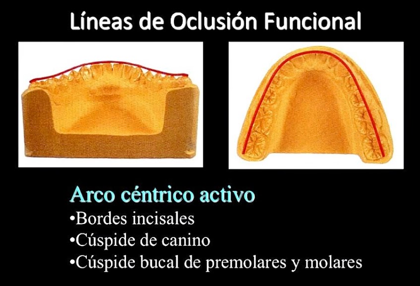 ORTODONCIA: Líneas de oclusión funcional