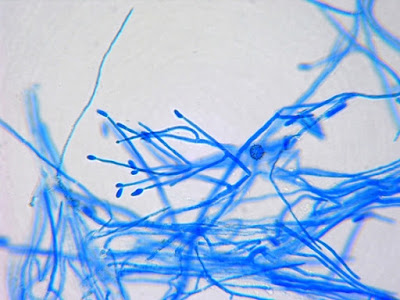 Fun With Microbiology (What's Buggin' You?): Sepedonium species