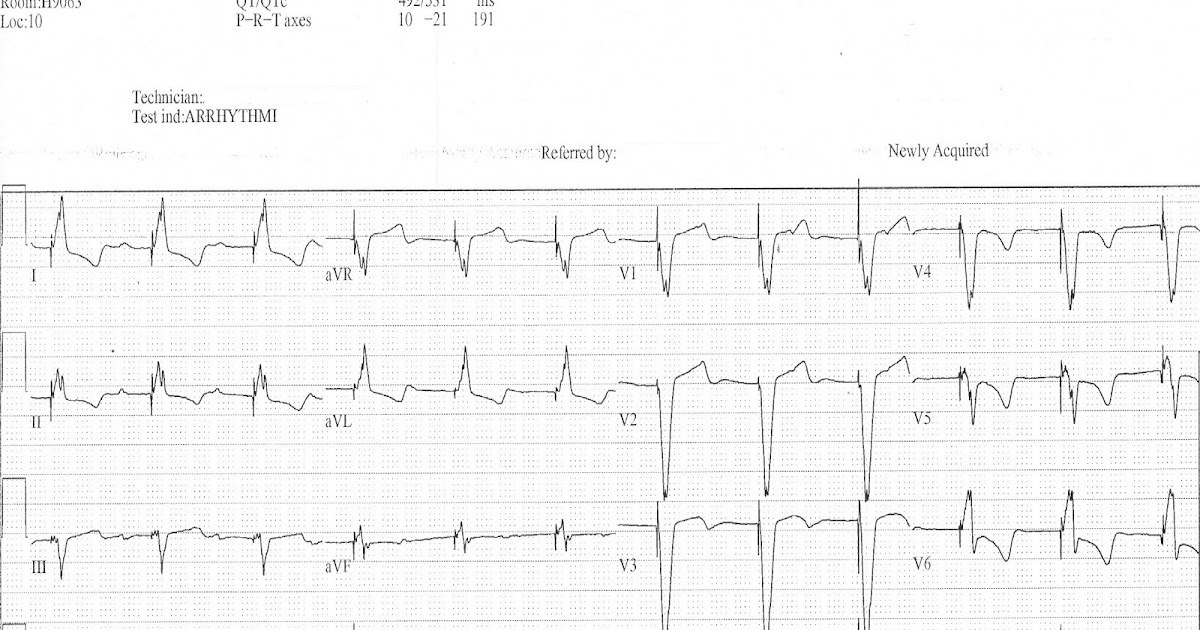 Pedi cardiology: EKG Quiz: Pacemaker