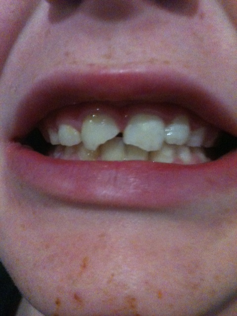 Hillbilly's at Heart