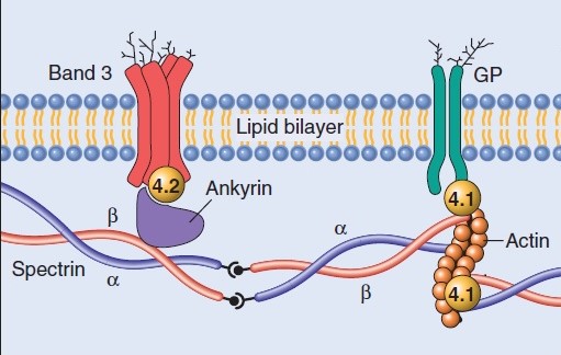 Hereditary Spherocytosis: Pathogenesis, Morphology, Clinical Features ...