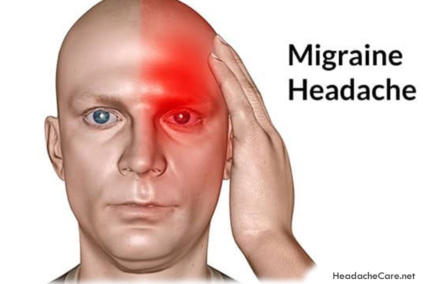 Apa itu Migrain? - Obat kesihatan anda