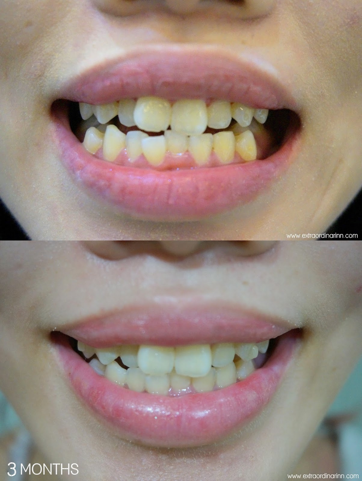 Carinn; carerynn | Malaysia Fashion, Beauty & Lifestyle Blog: Carinn x ...