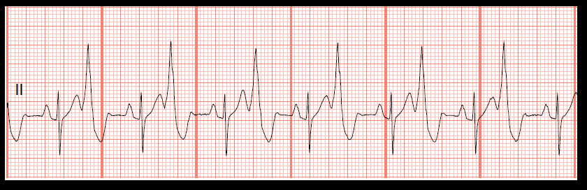 Practice EKG Strips 347