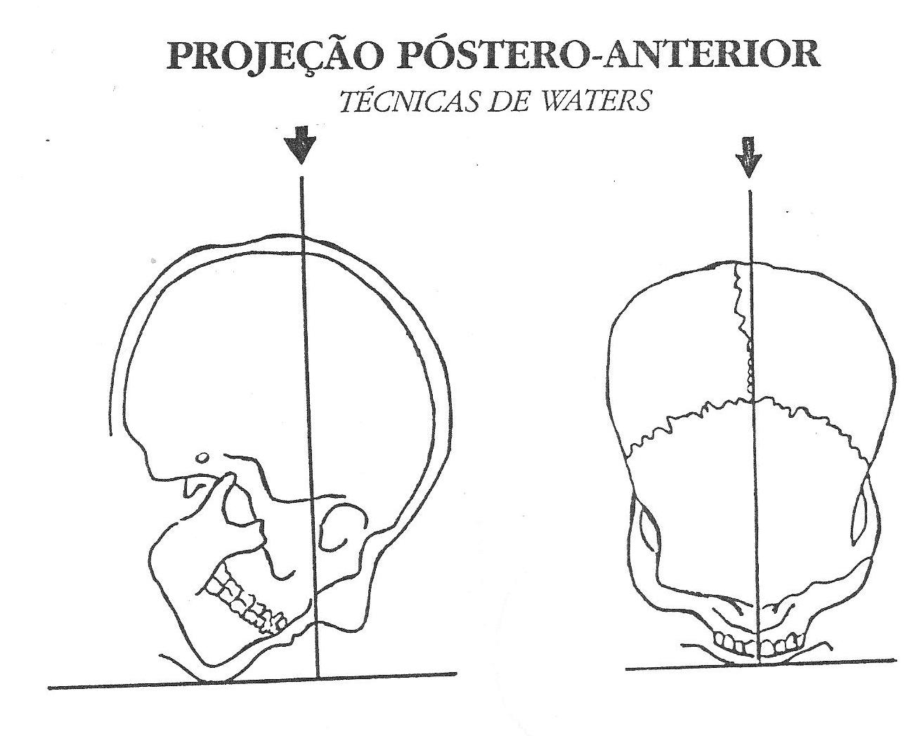 "Te vejo por dentro": Projeção Anterior (P.A.) de Waters