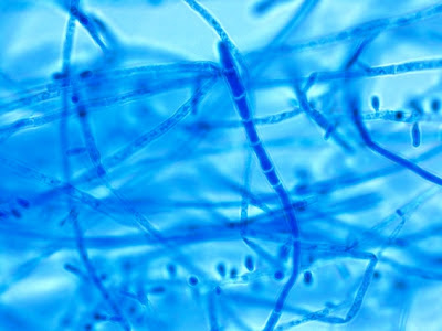 Fun With Microbiology (What's Buggin' You?): Trichophyton tonsurans