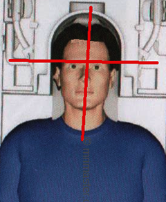 Teknik MRI Brain ~ MRI POSITIONING