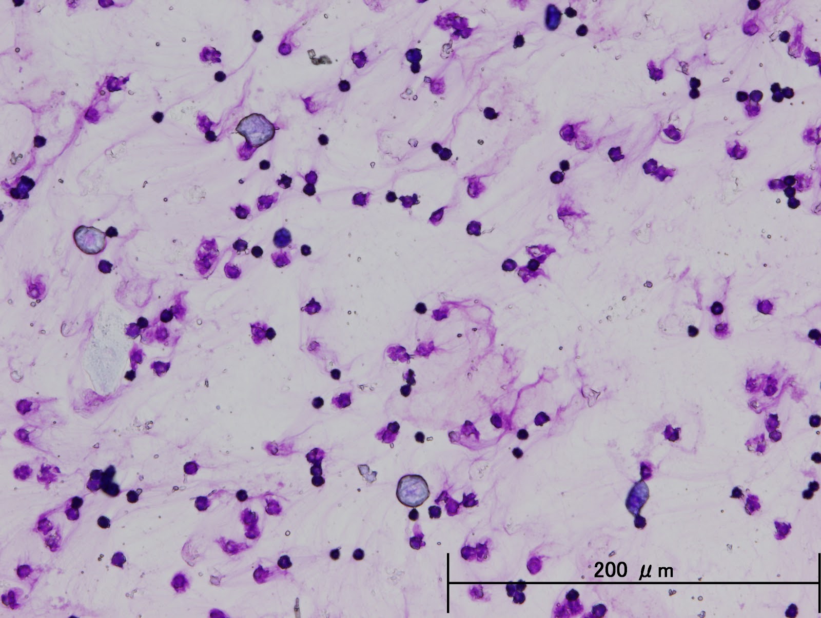 Pramod Dhakal's: Guide for Rat Smear (Diestrus, Proestrus, Estrus and ...