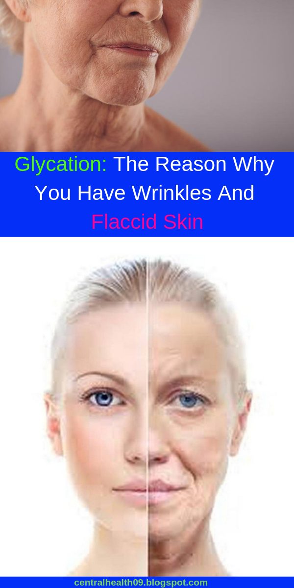 Glycation: The Reason Why You Have Wrinkles And Flaccid Skin - Healthy ...