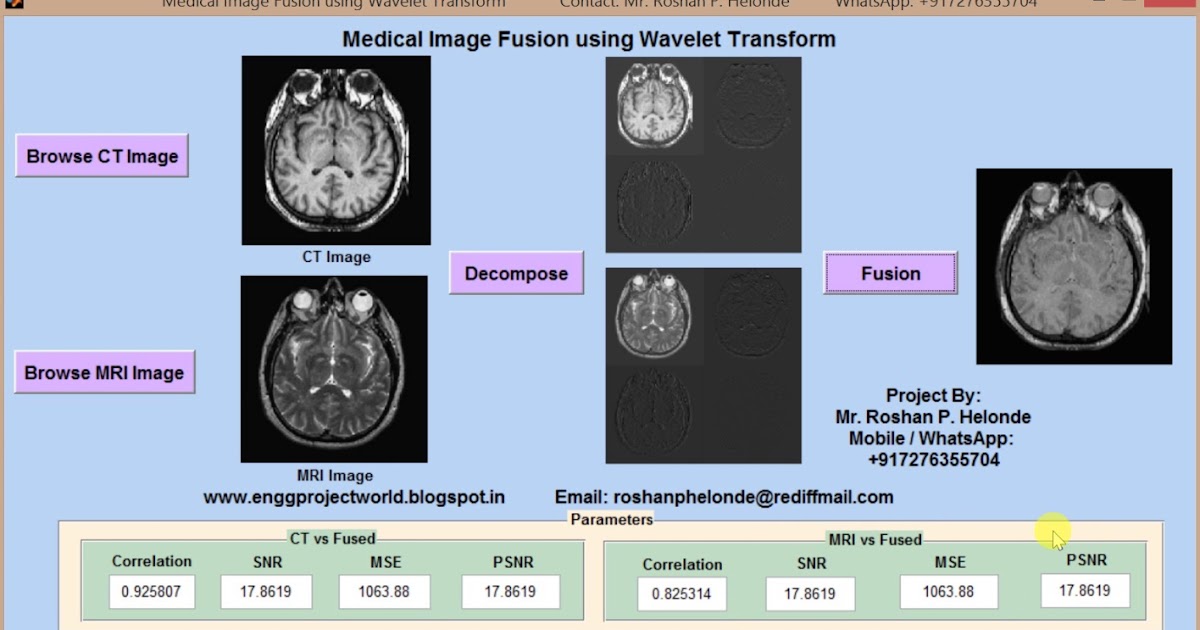Medical Image Fusion using Wavelet Transform Matlab project source code ...
