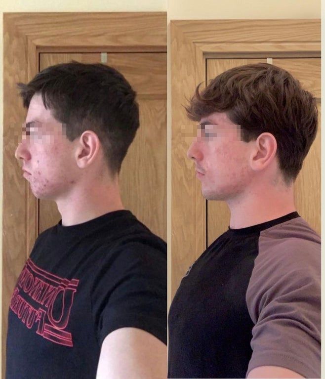 Những điều bạn cần biết về mewing ~ The beausty