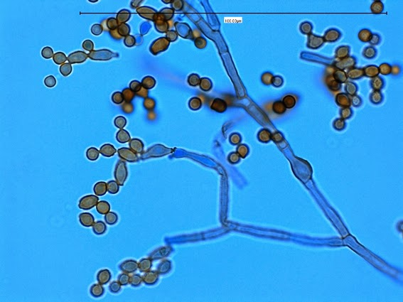 Fun With Microbiology (What's Buggin' You?): Cladosporium species ...