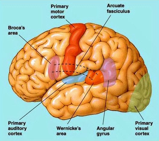 Ashley's Physiological Psychology Blog: What is Wernicke's Aphasia?