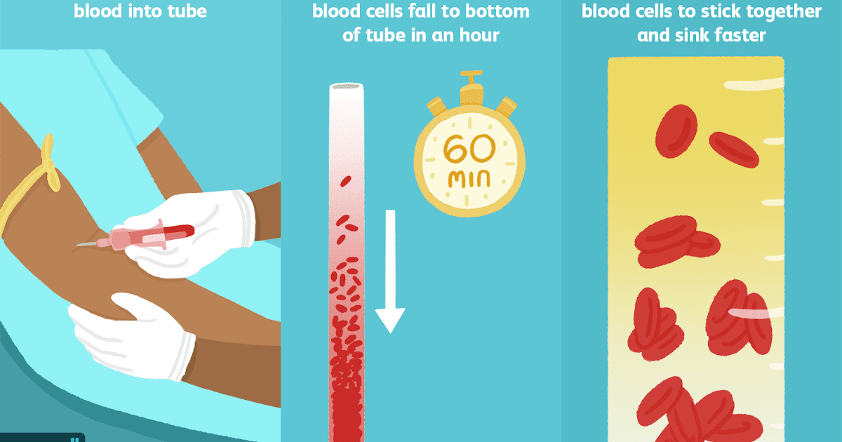 Clinical Analysis Laboratory: CLINICAL BLOOD HAEMATOLOGY - ERYTHROCYTE ...