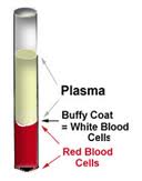 On the Road to Vet School: PCV & TP