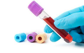 Numération de Formule Sanguin (NFS) ~ ProBiologiste