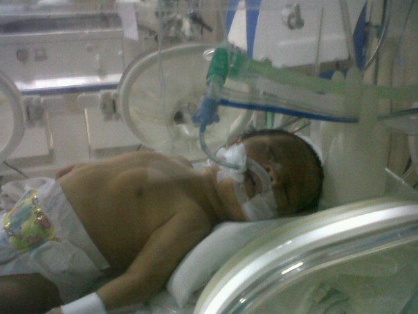 Bagaimana cara suplementasi oksigen pada neonatus ??? Mau tau ...