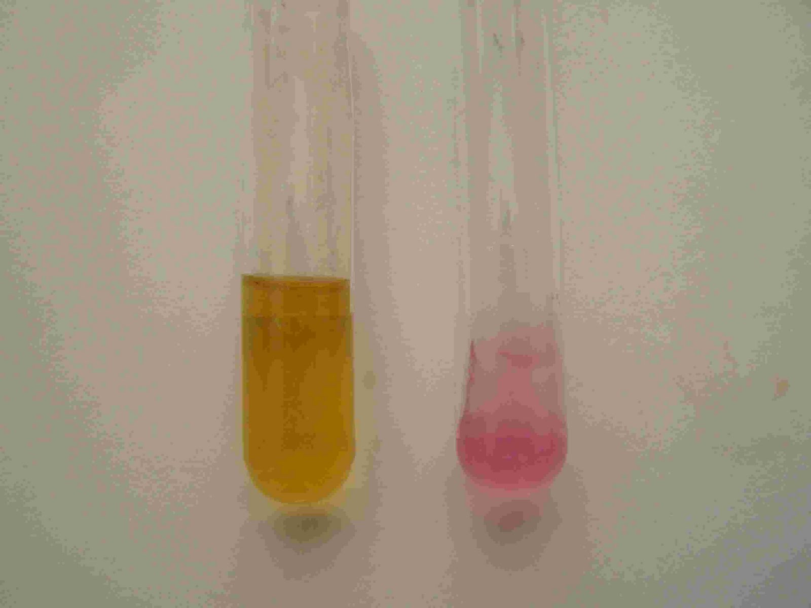 BIOLOGI I: LAPORAN PRAKTIKUM MIKROBIOLOGI UMUM IDENTIFIKASI BAKTERI ...