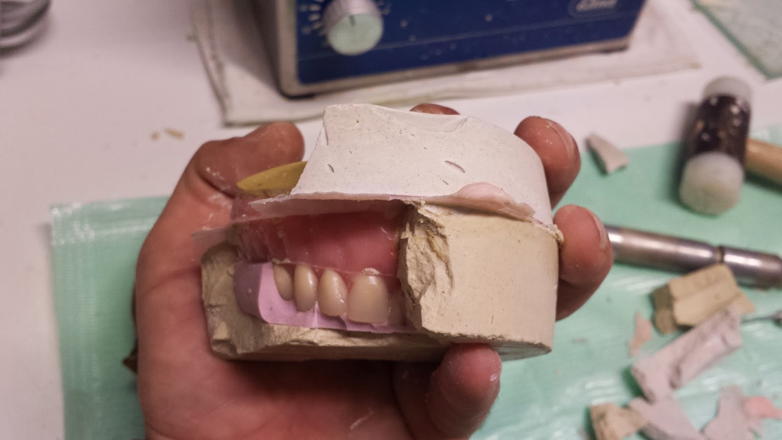 Creadores de Sonrisas: Renovación de prótesis tras 30 años de uso