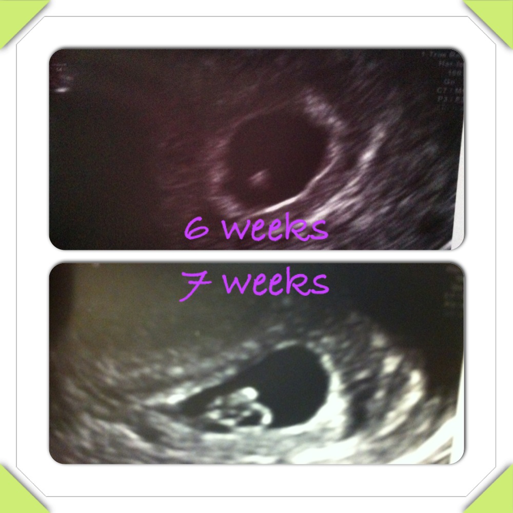 Little Baby Smith: 7 weeks and our second ultrasound