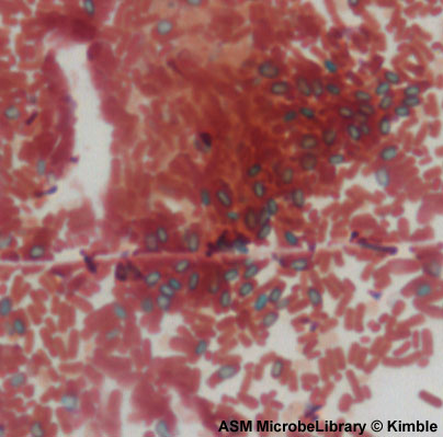 B subtilis endospore stain - pdfrosd