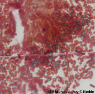 Samantha and Sarah's Microbiology Lab Journal: Creating an Endospore ...