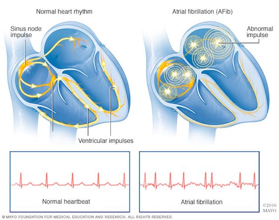 Enfermería Profesional: Propiedades Fundamentales del Pulso