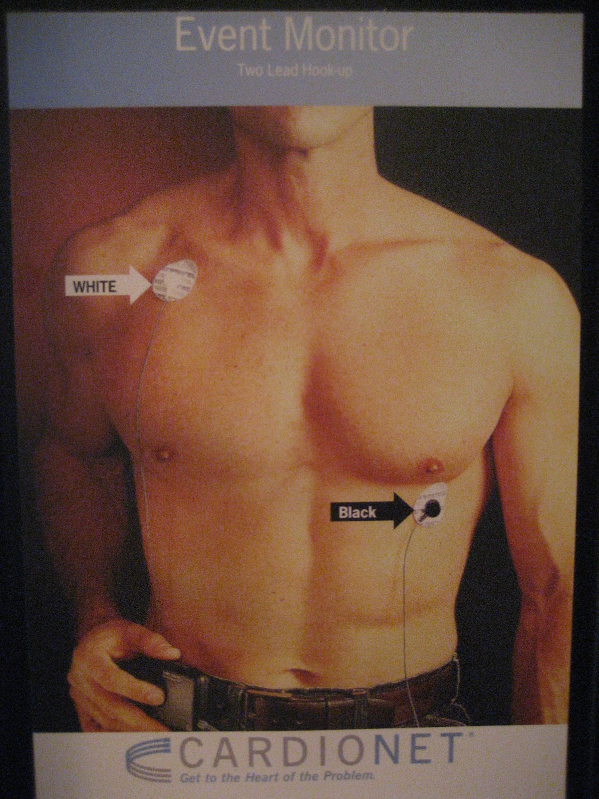 Check out my new heart...monitor. : r/pics