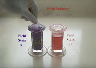 Blood Smear Slide Staining कैसे करते हैं - Field Stain ~ Lab Test Hindi