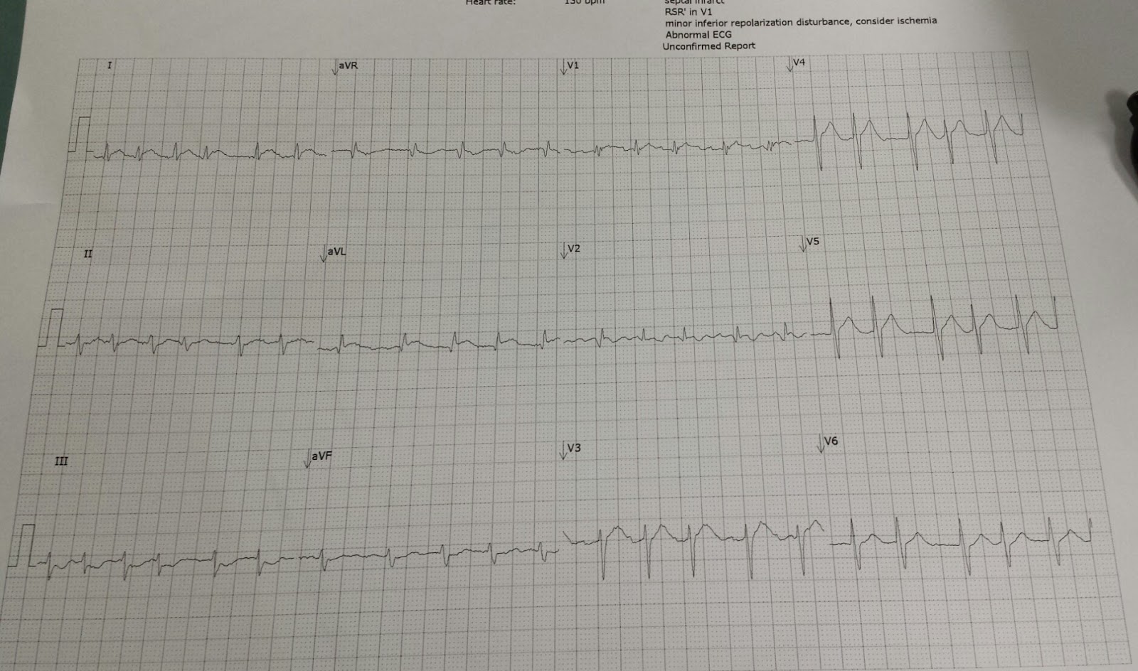 Hannah in Fiji: Poison from fish? Does that mean DON'T eat the sushi...